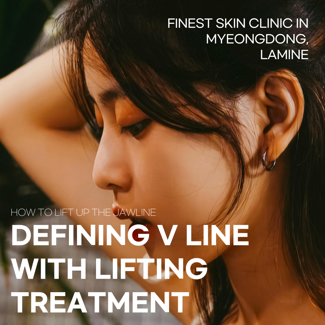 Defining V-Line With Lifting Treatment – Korea Skin Clinic in Myeong-dong